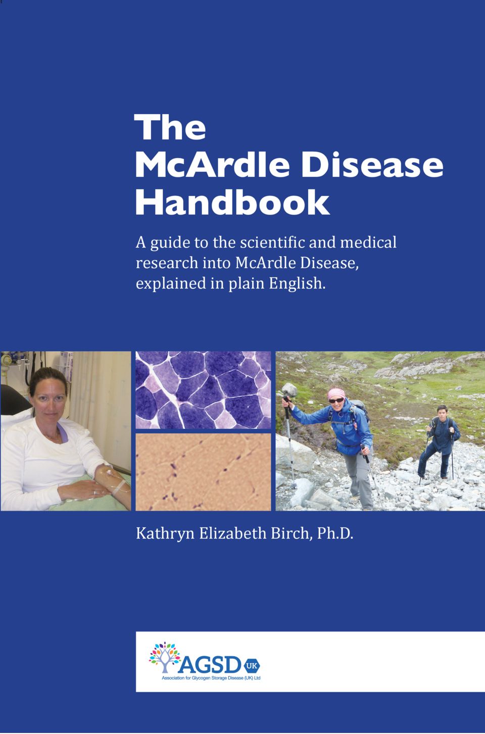 The McArdle Disease Handbook : simplebooklet.com