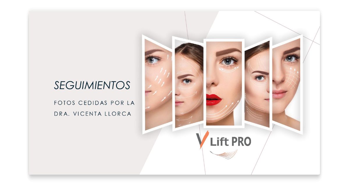 V Lift Pro Seguimiento : simplebooklet.com