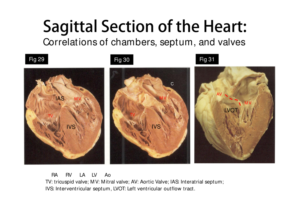 Cardiacanatomy