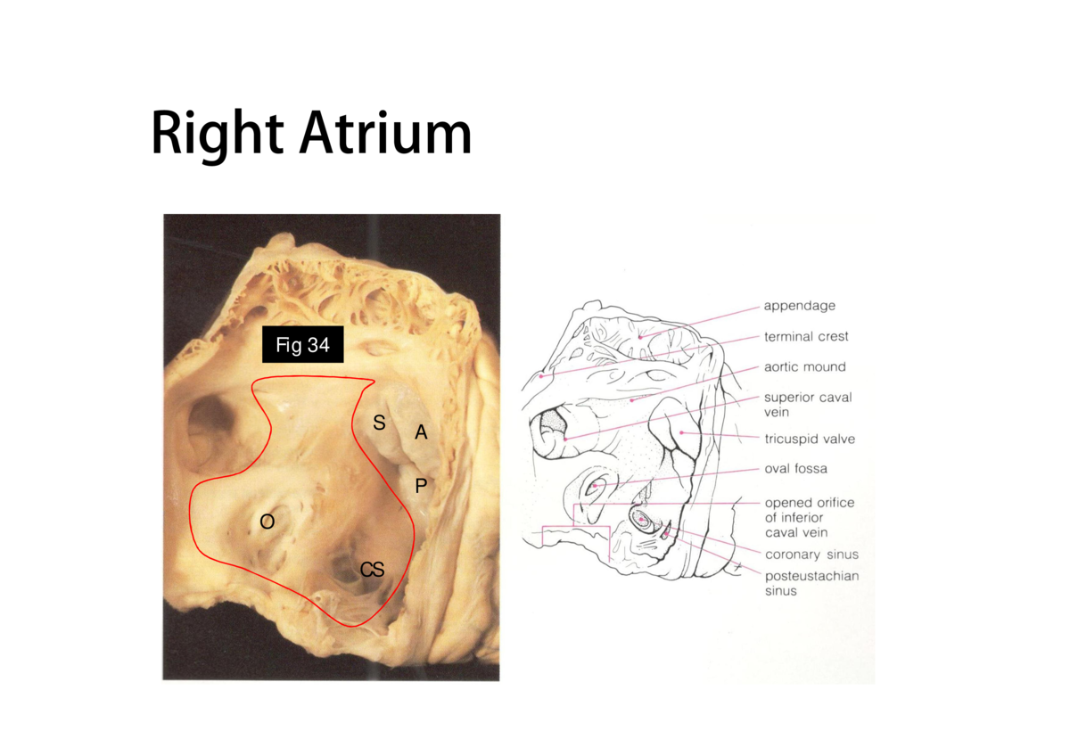 Cardiacanatomy
