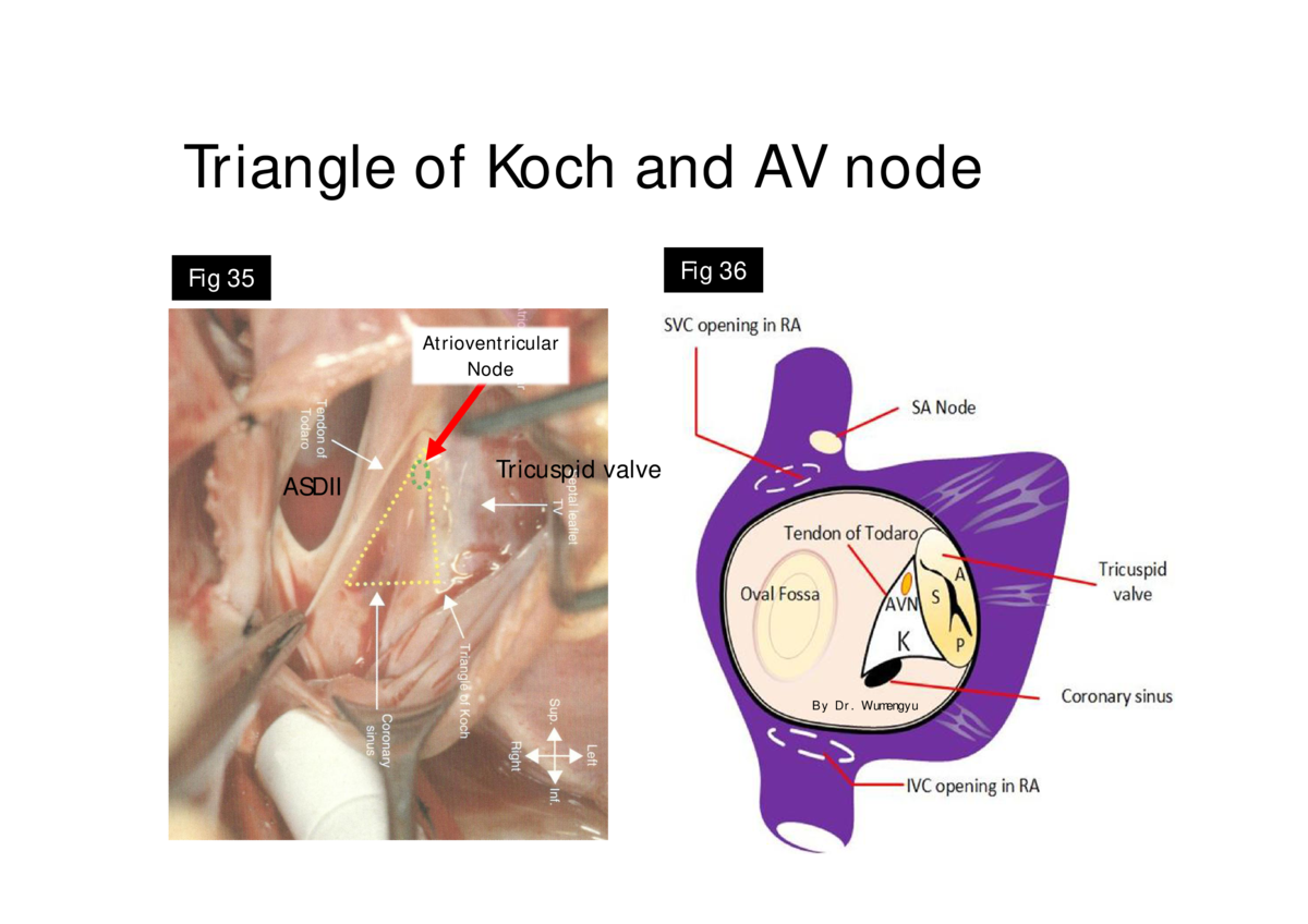 Cardiacanatomy