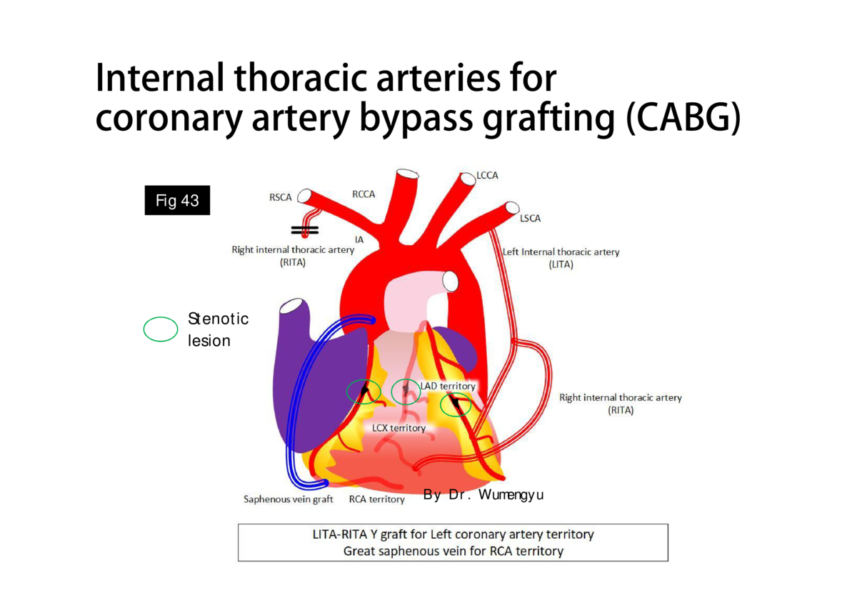 Cardiacanatomy